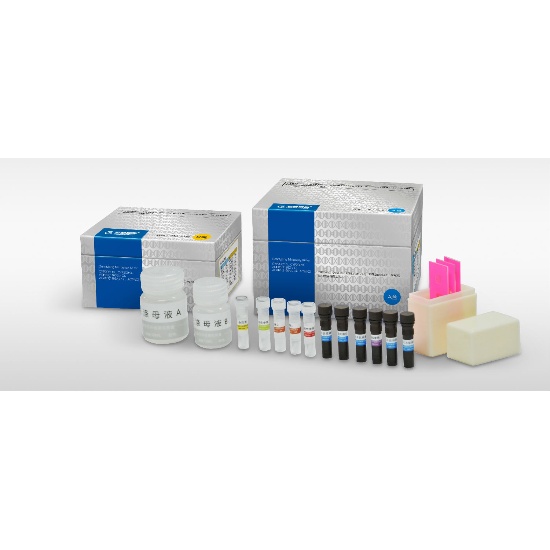 Genotyping Microarray Testing For Hypertension | Health Care & Medical ...