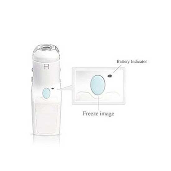 Mini Colposcope | Health Care & Medical Supplies | Health, Beauty and ...