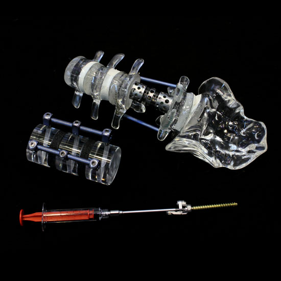 Spine Internal Fixation System | Health Care & Medical Supplies ...